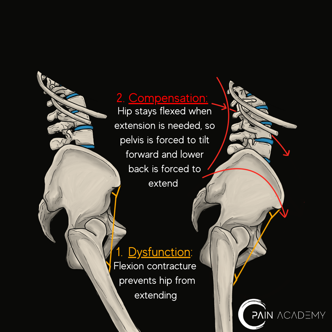 The Spine Does What The Hips Can’t – Pain Academy